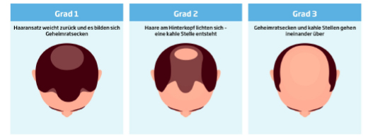 MINOXICUTAN Männer 50 mg/ml Spray - apotal.de - Ihre Versandapotheke